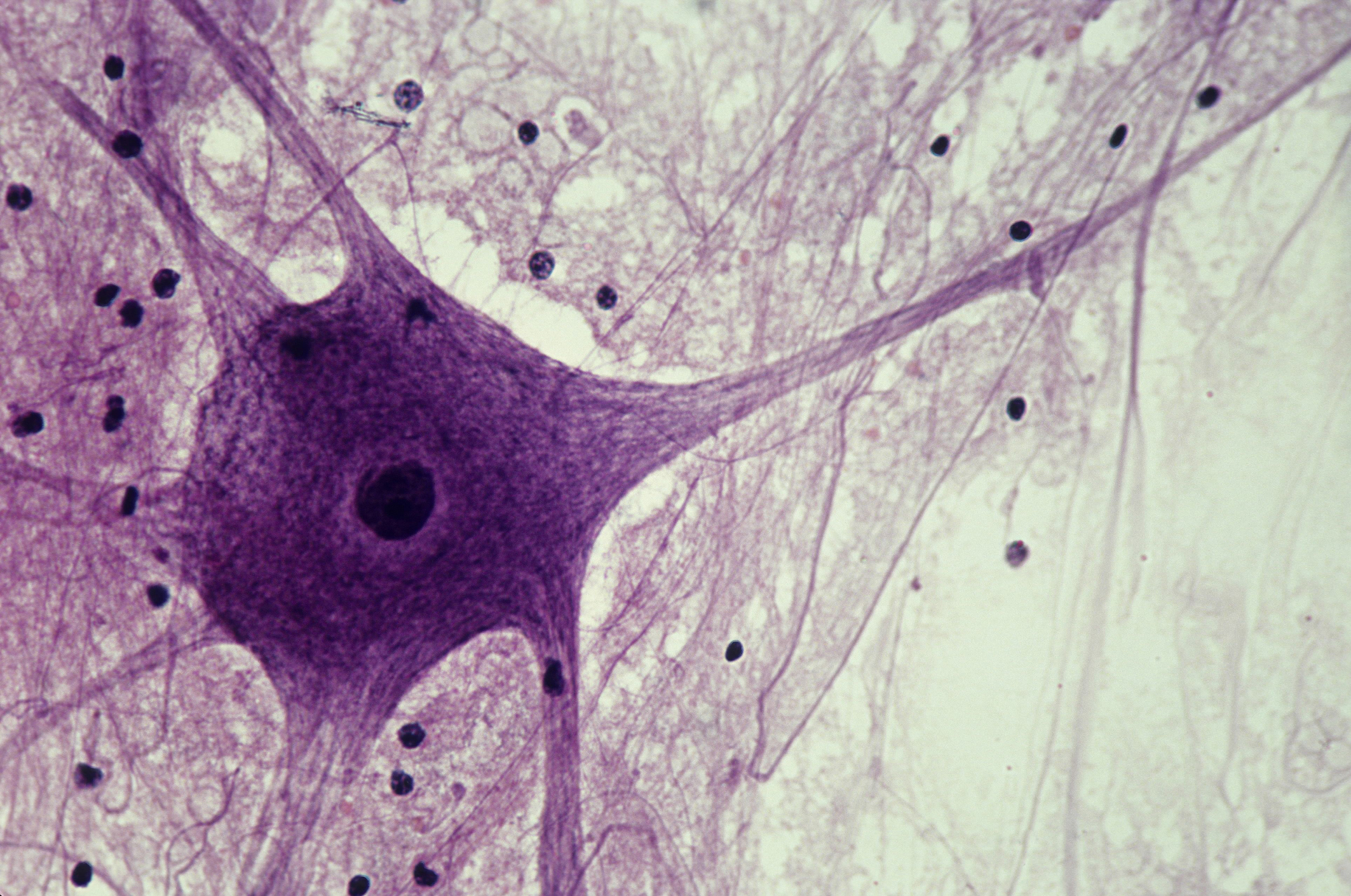 Primary Neuron RNA Silencing Guide | AUM silence sdASO | Transfection-Free